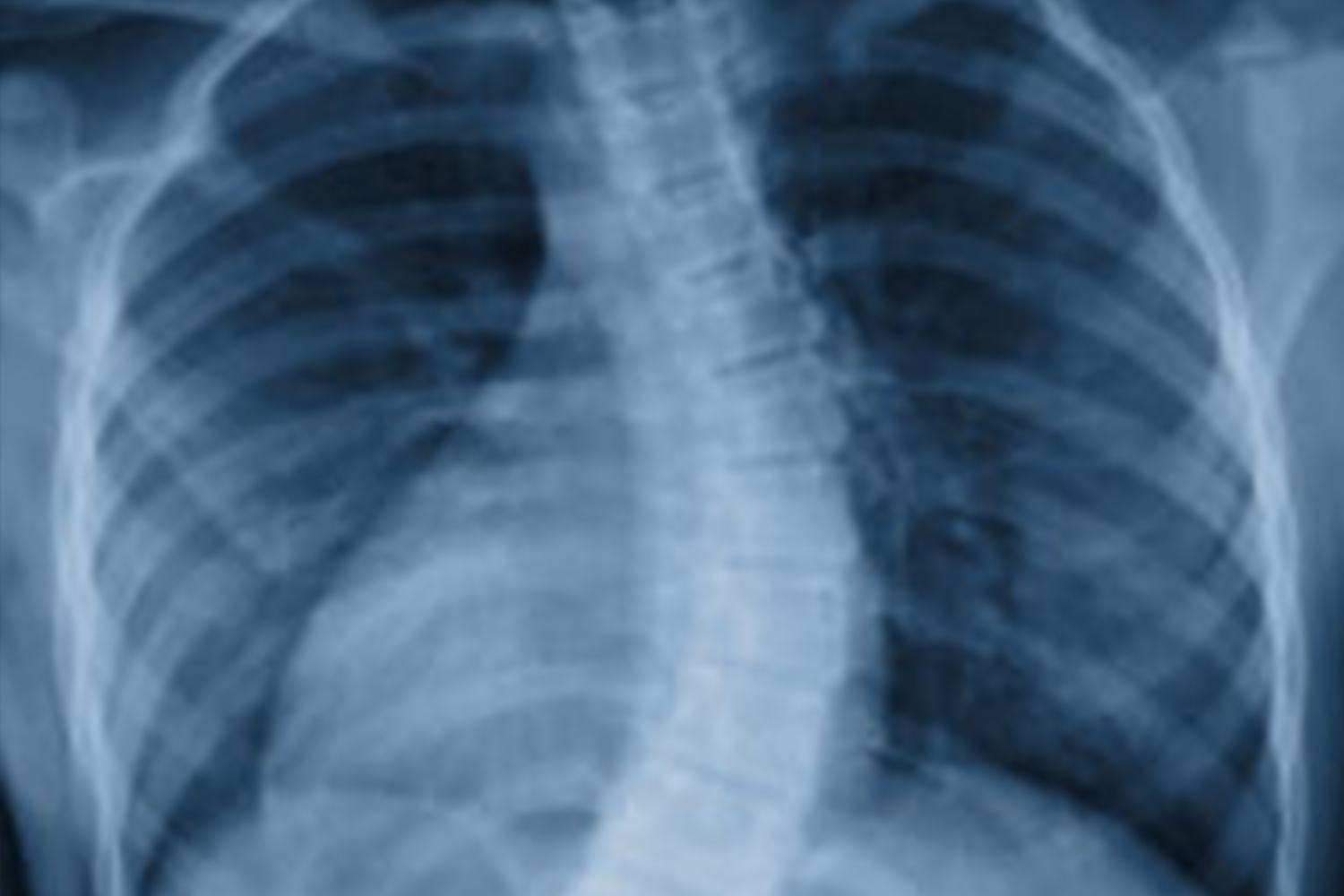 Subluxation - Core Chiropractic & Wellness